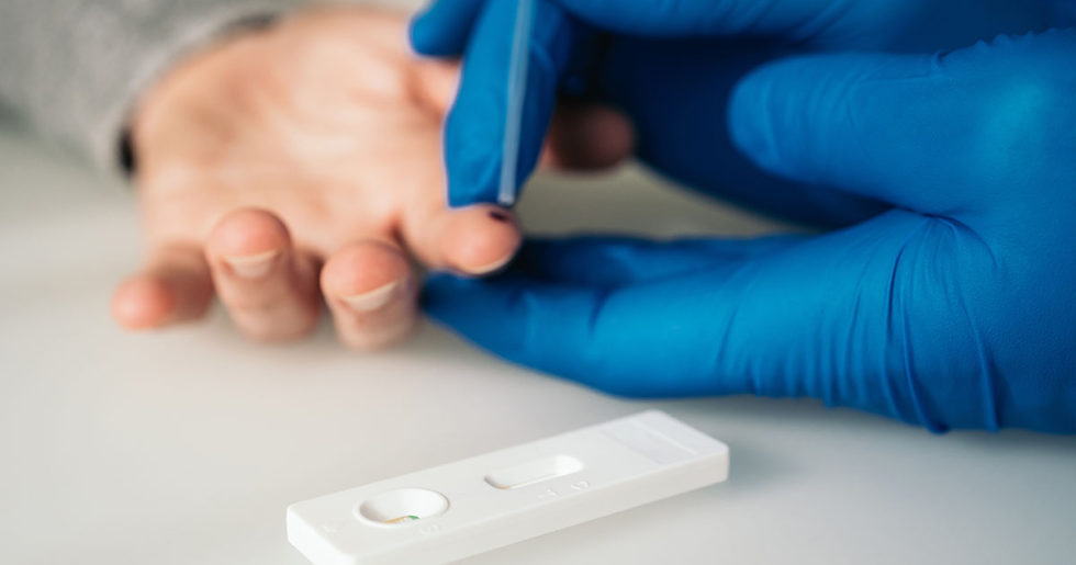 Toutes les démarches pour faire le test sérologique Covid
